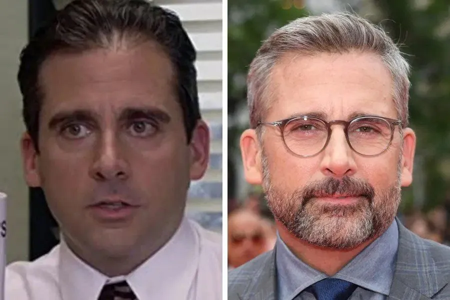 Steve Carell’s Hair Transplant: The Man Behind the Transformation ...